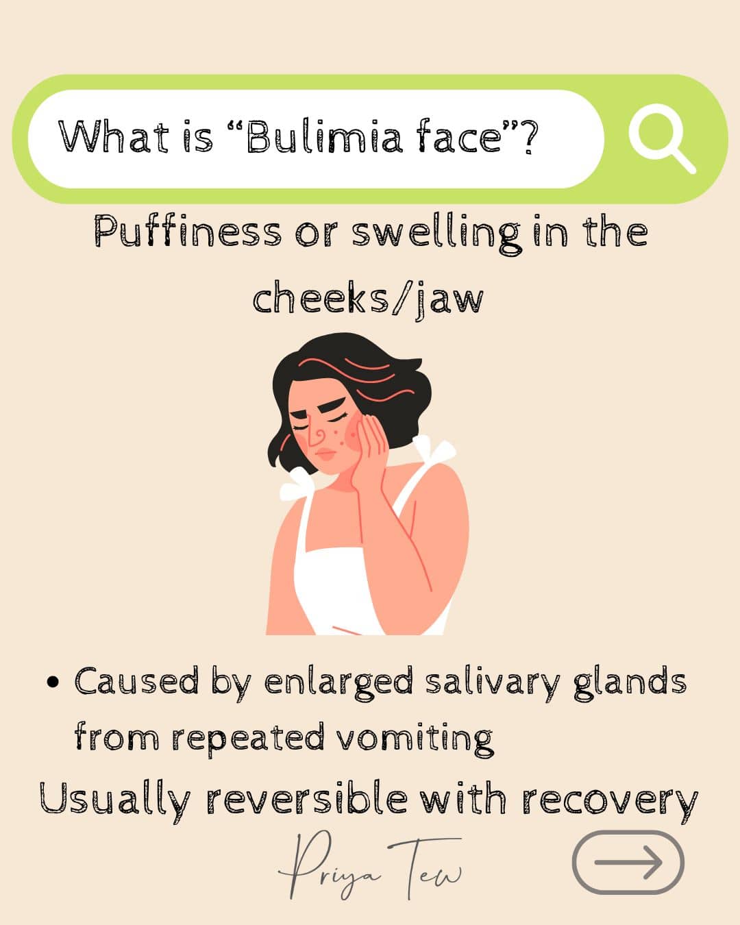 Bulimia face, bulimia knuckles - signs to look out for. - Dietitian UK